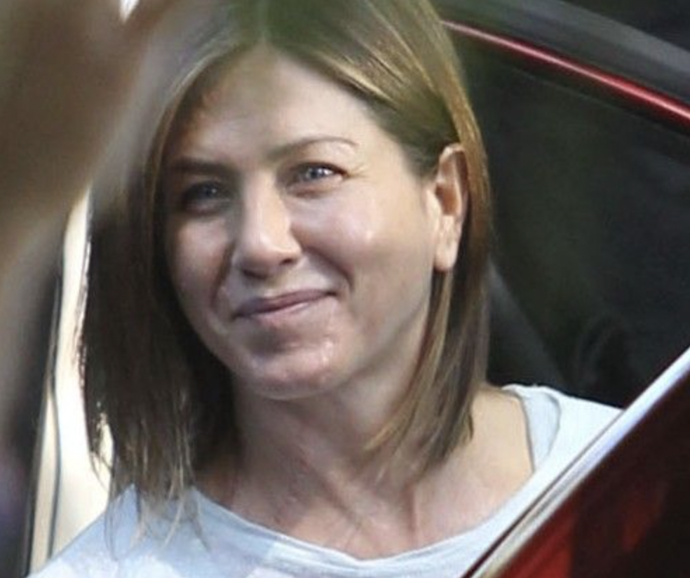 When a photo of Jennifer without makeup and with facial scars emerged ...